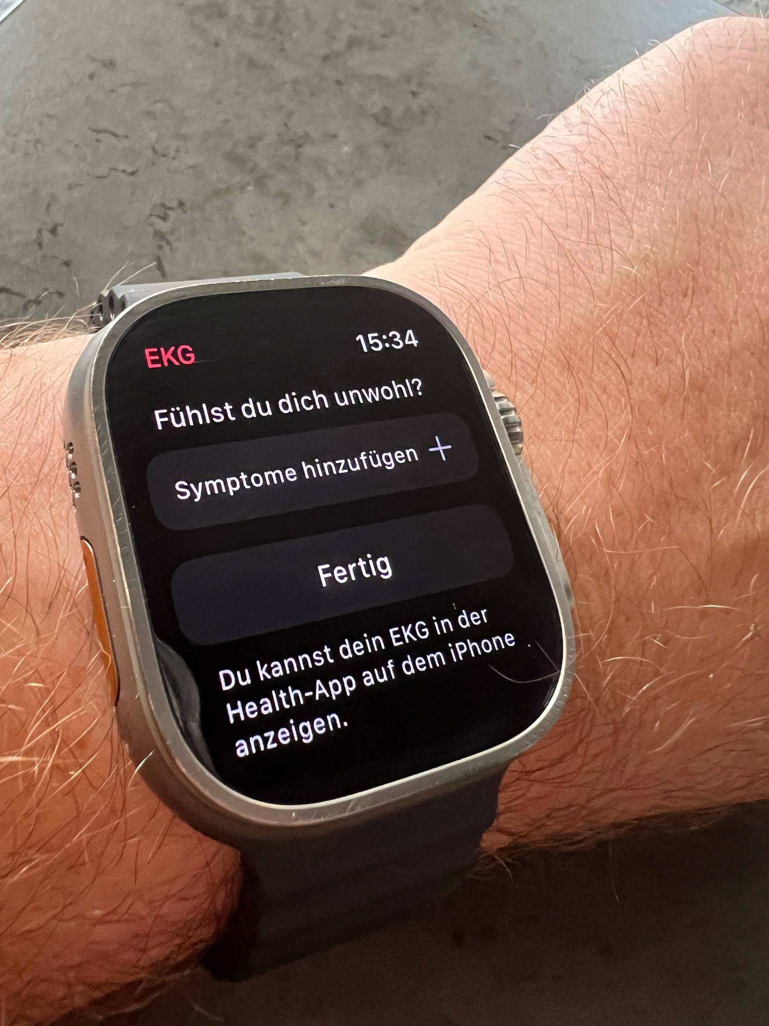 Smartwatch EKG Test & Vergleich » Top 11 im Dezember 2025