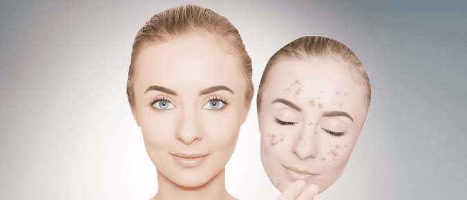 Creme gegen Pickel Vergleich & Test » Top 11 im Januar 2026