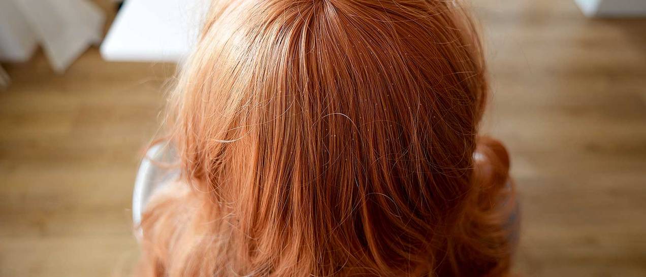 Läuseprävention: 8 schützende Maßnahmen & Mittel