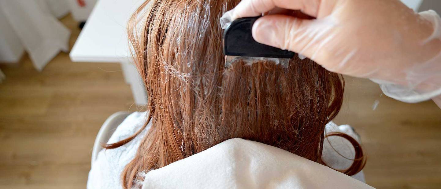 Läuseprävention: 8 schützende Maßnahmen & Mittel