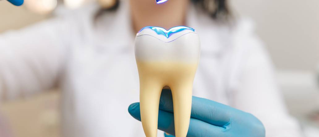 Zahnzement Test & Vergleich » Top 13 im Januar 2026