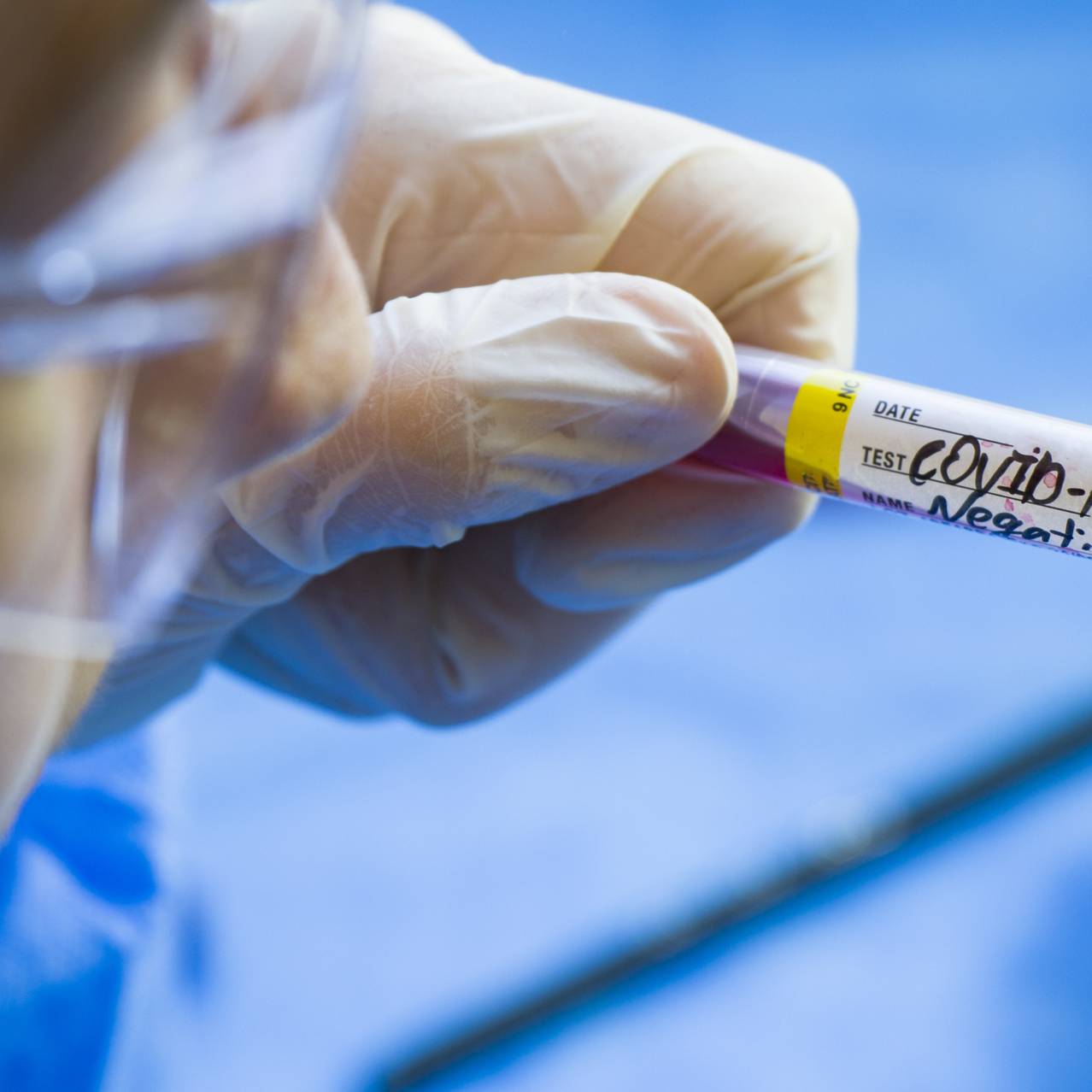 Coronavirus-Schnelltest Test & Vergleich 2026 auf N-TV » Die besten ...